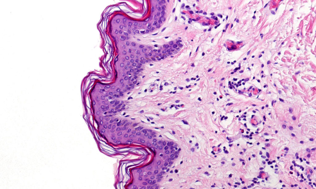 ABRASIVE COURSE - Skin Tech Pharma Group